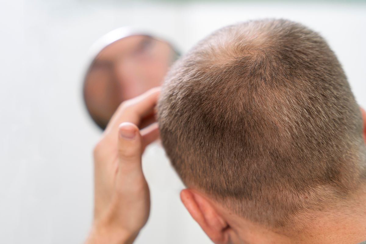 5 causas de la caída de cabello y formas seguras de tratarla – Blog Locatel